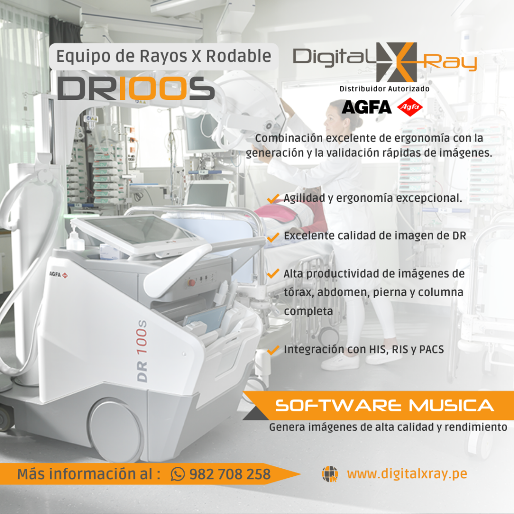 EQUIPO DE RX RODABLE DIGITAL DIRECTO DR 100 S - Digital X Ray